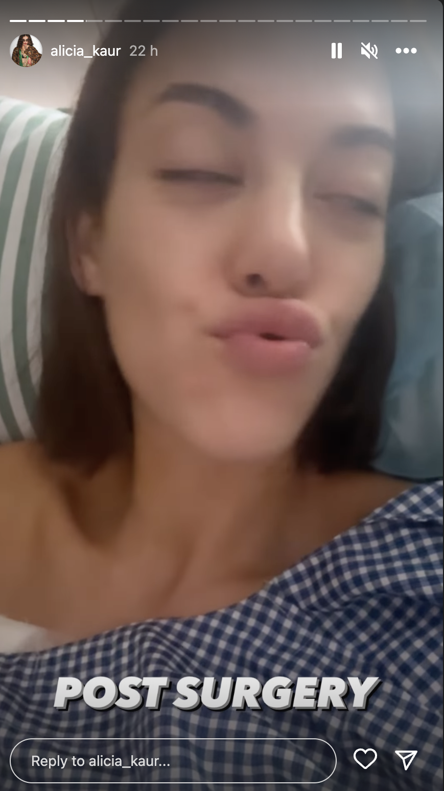 Indian Model Alicia Kaur Documents Bo*b Job Journey On Instagram ...