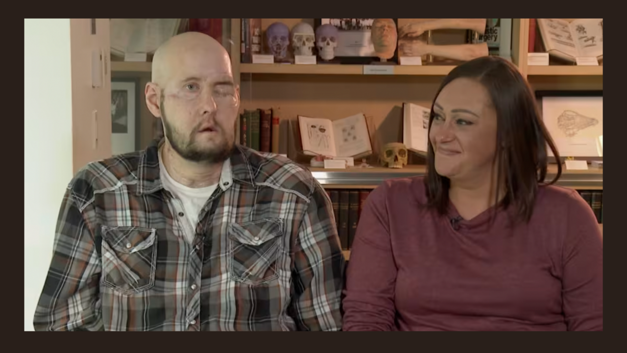 Who is Aaron James, World’s First Human Eyeball Transplant Recipient? | World News, Times Now