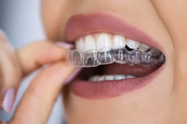 International Retainer Day: दातांची स्थिती आणि आकार सुधारण्यासाठी ...