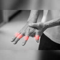 Stiff Skin Syndrome: This rare disease can make the skin turn stony