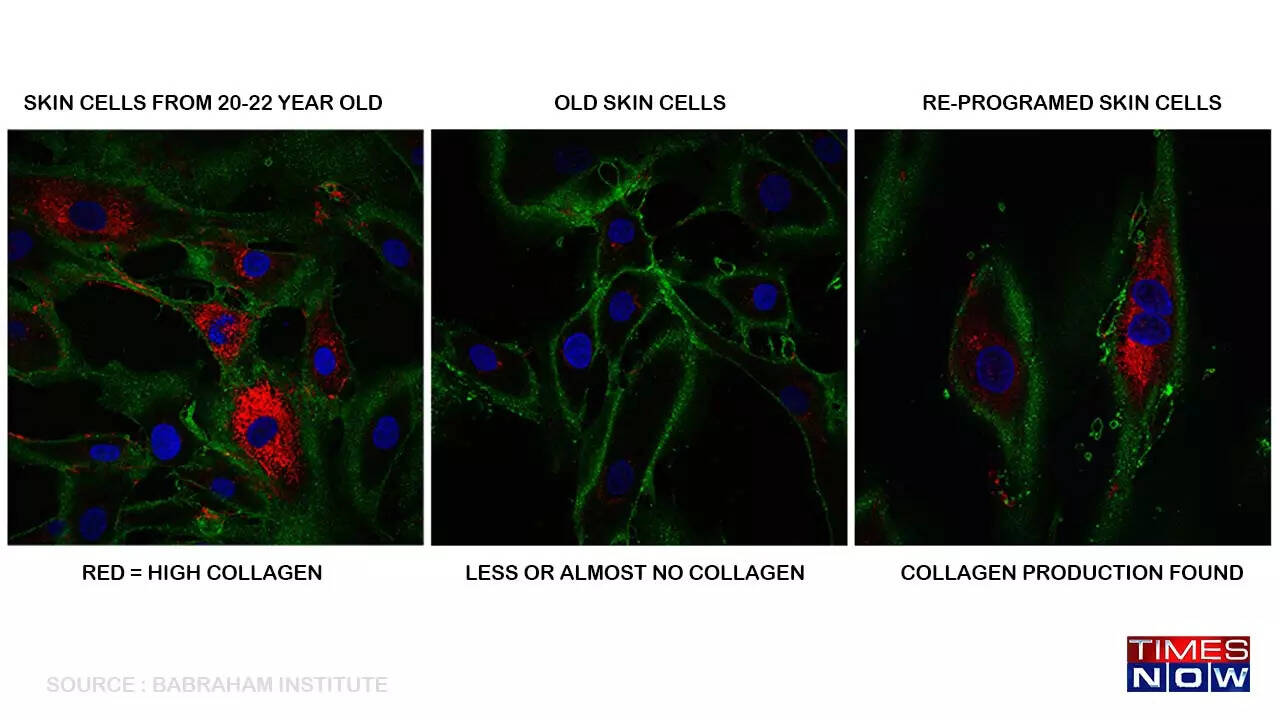 Scientists discover a new technique to make skin look and feel 30 years ...