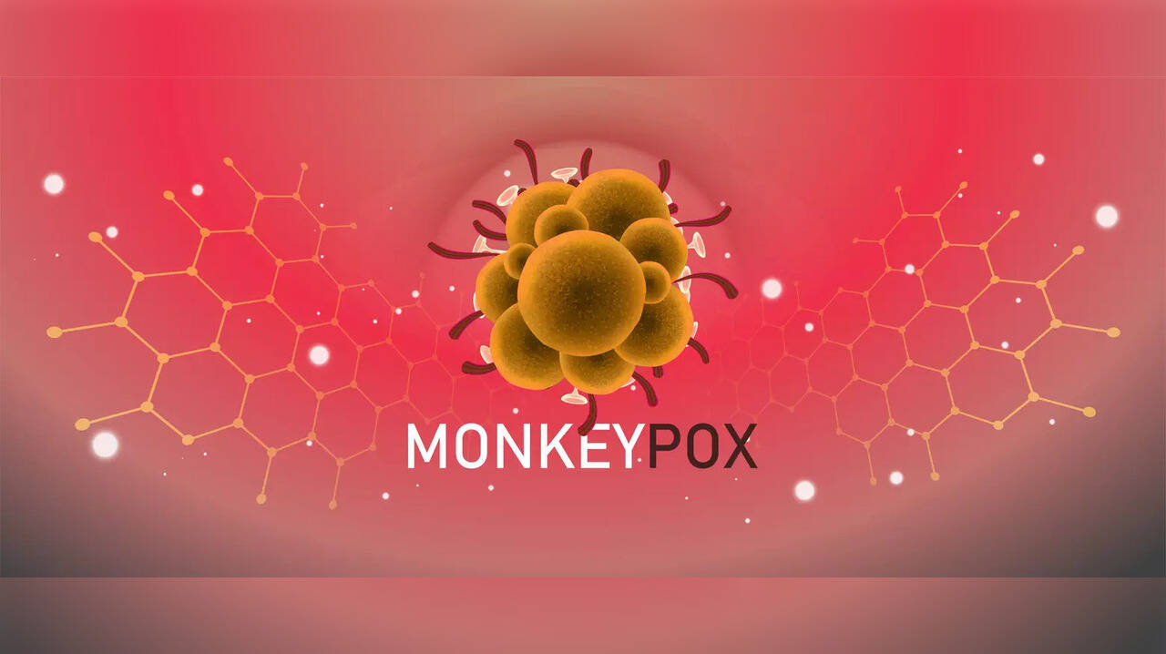 Monkeypox NOT a mild viral illness anymore; symptoms differ from ...