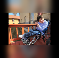 'Miracle' boy born with 'two faces' defies odds to celebrate 18th birthday