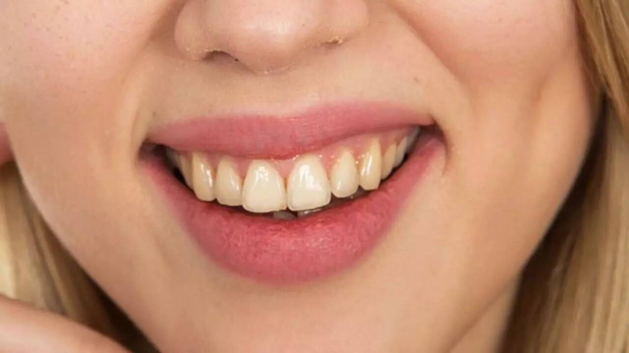 Personality test: Square or triangle? Find what the shape of your teeth ...