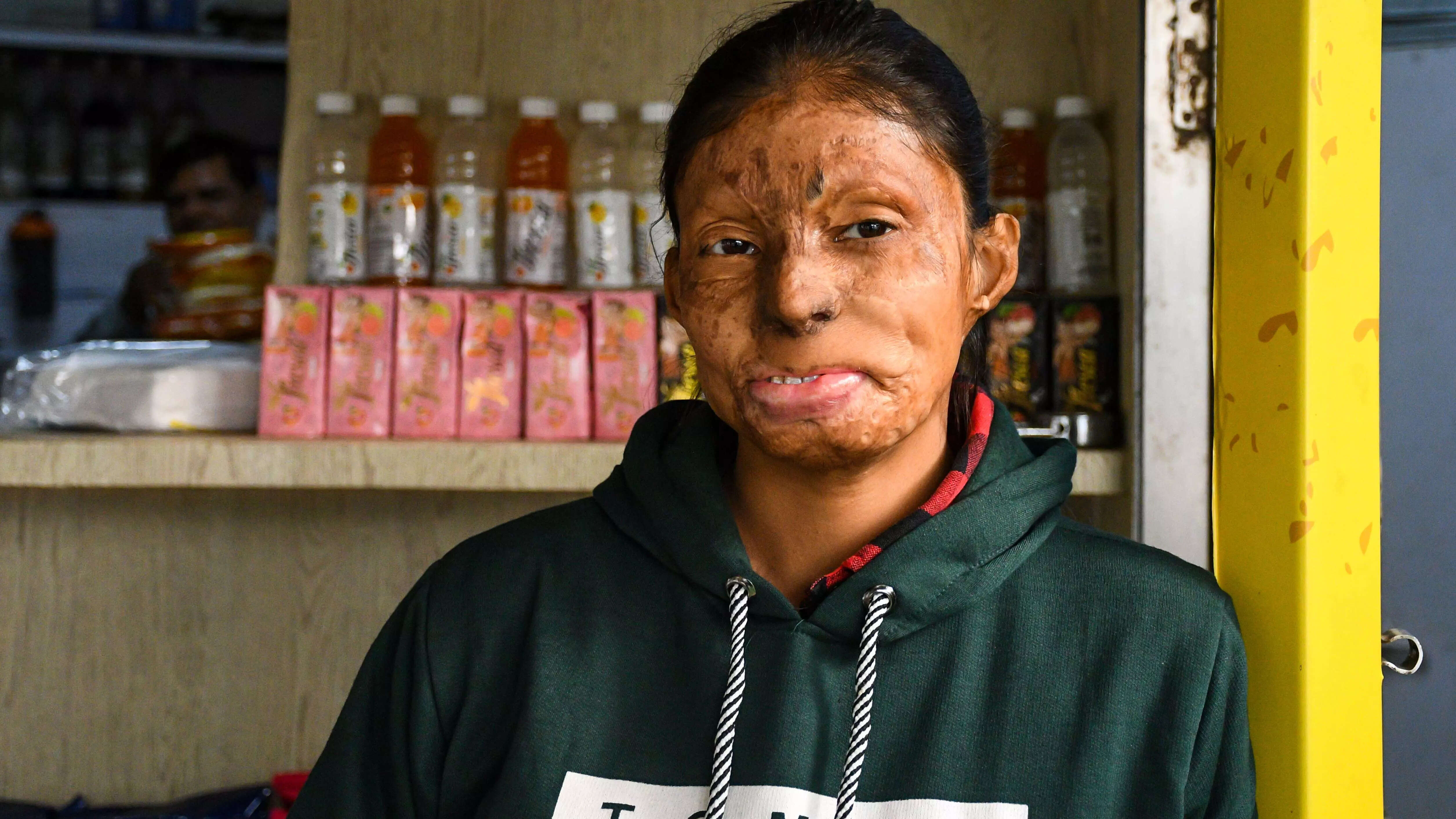 How Sheroes' Hangout cafe in Noida is helping acid attack survivors ...