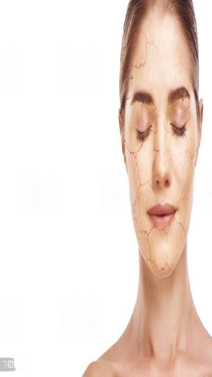 Natural ways to take care of your dead skin in winters