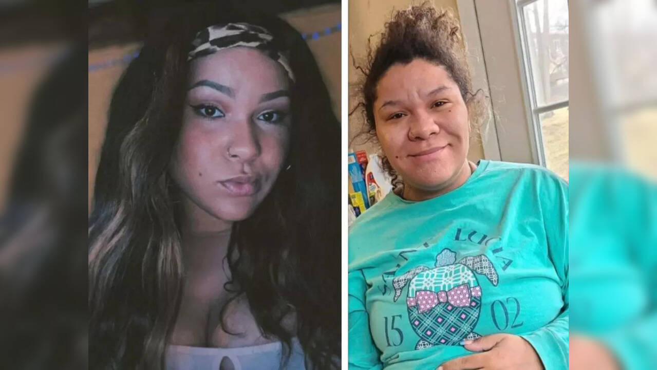 Shocking! Woman suffers from a bizarre pregnancy side effect, starts to ...