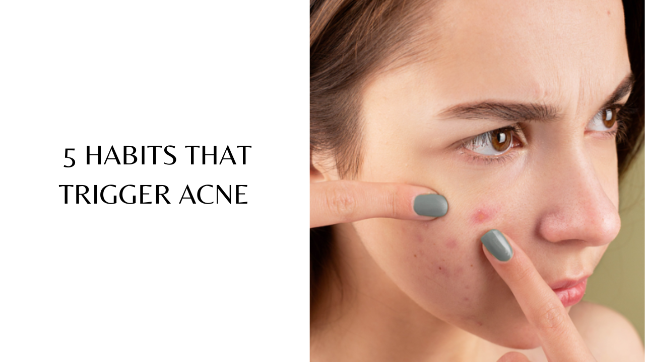 Skincare: Stop These 5 Habits Before Your Acne Gets Any Worse ...