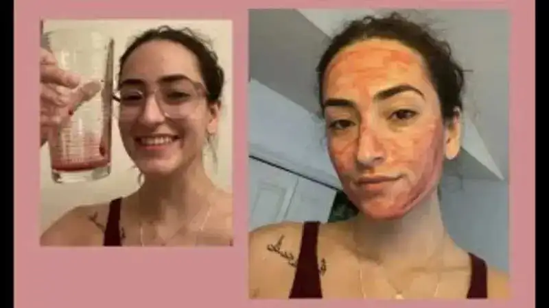 Period-blood face mask for beauty benefits? Know what experts have to ...
