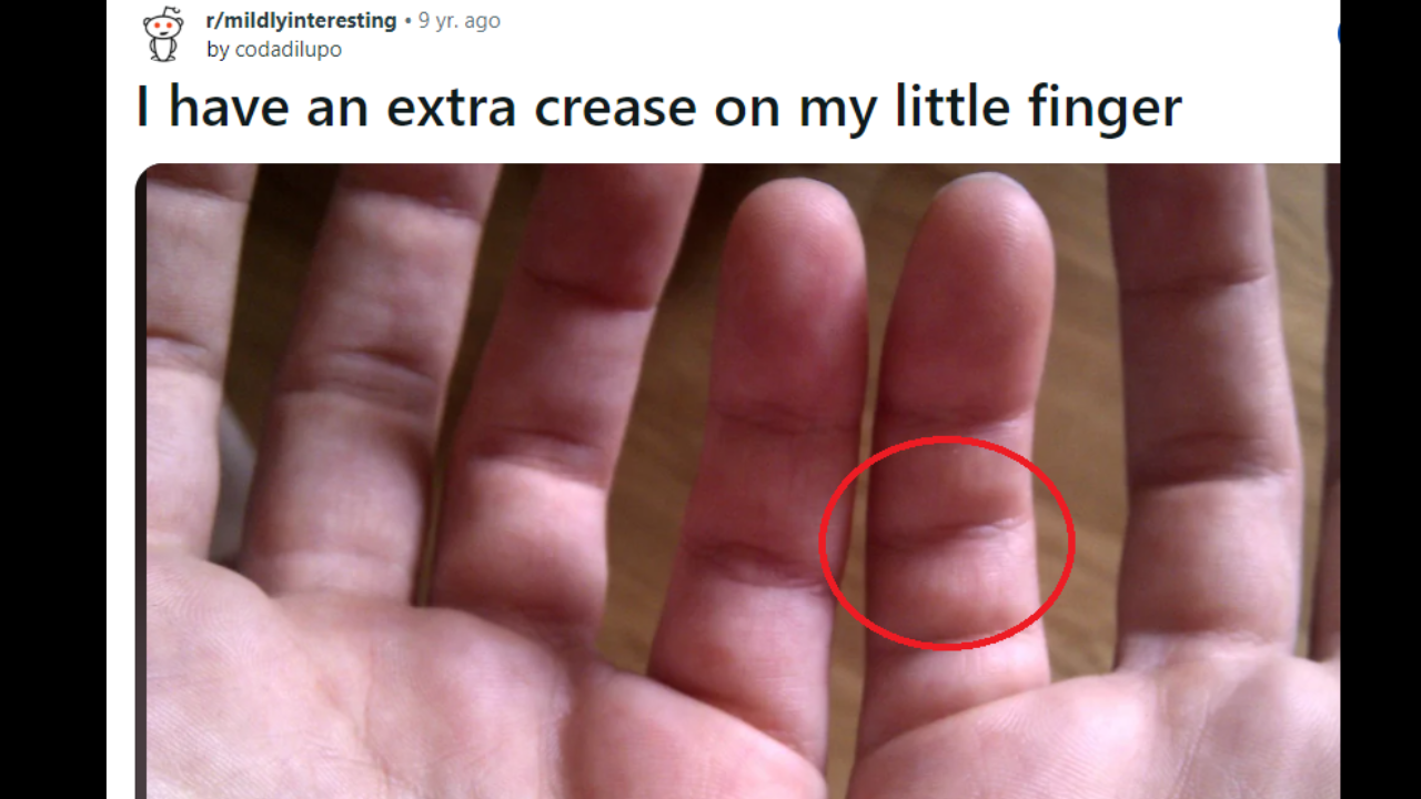 Got An Extra Crease On Your Pinky Finger? Only A Small Number Of People ...