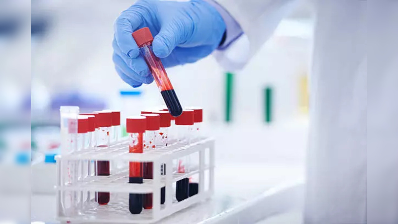 New blood test to detect 50 types of cancer shows promise | Health News ...