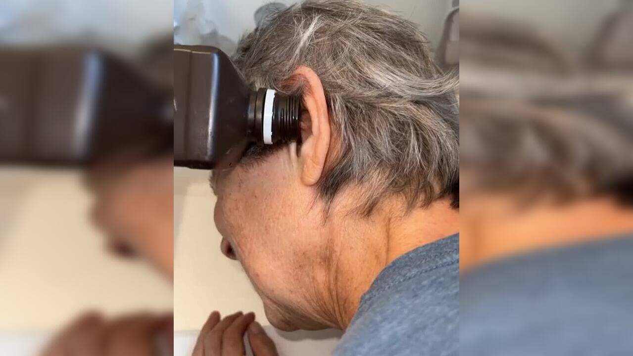 Spider Crawls Out Of Woman's Ear In Shocking Viral Video | Times Now