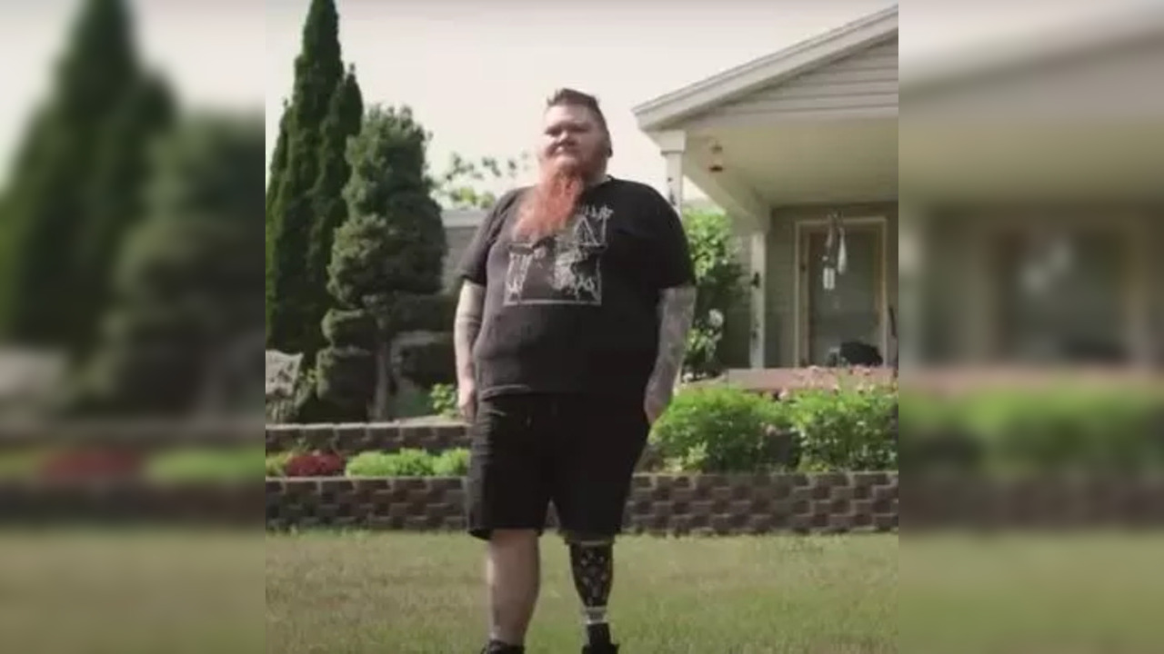 US Woman Grabs Guinness Record For Longest Beard She Developed Due To ...