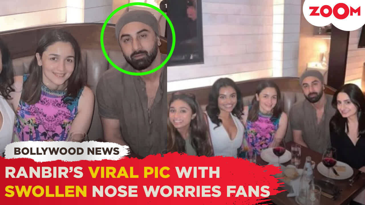 Ranbir Kapoor's swollen nose RAISES CONCERNS as he parties with Alia ...
