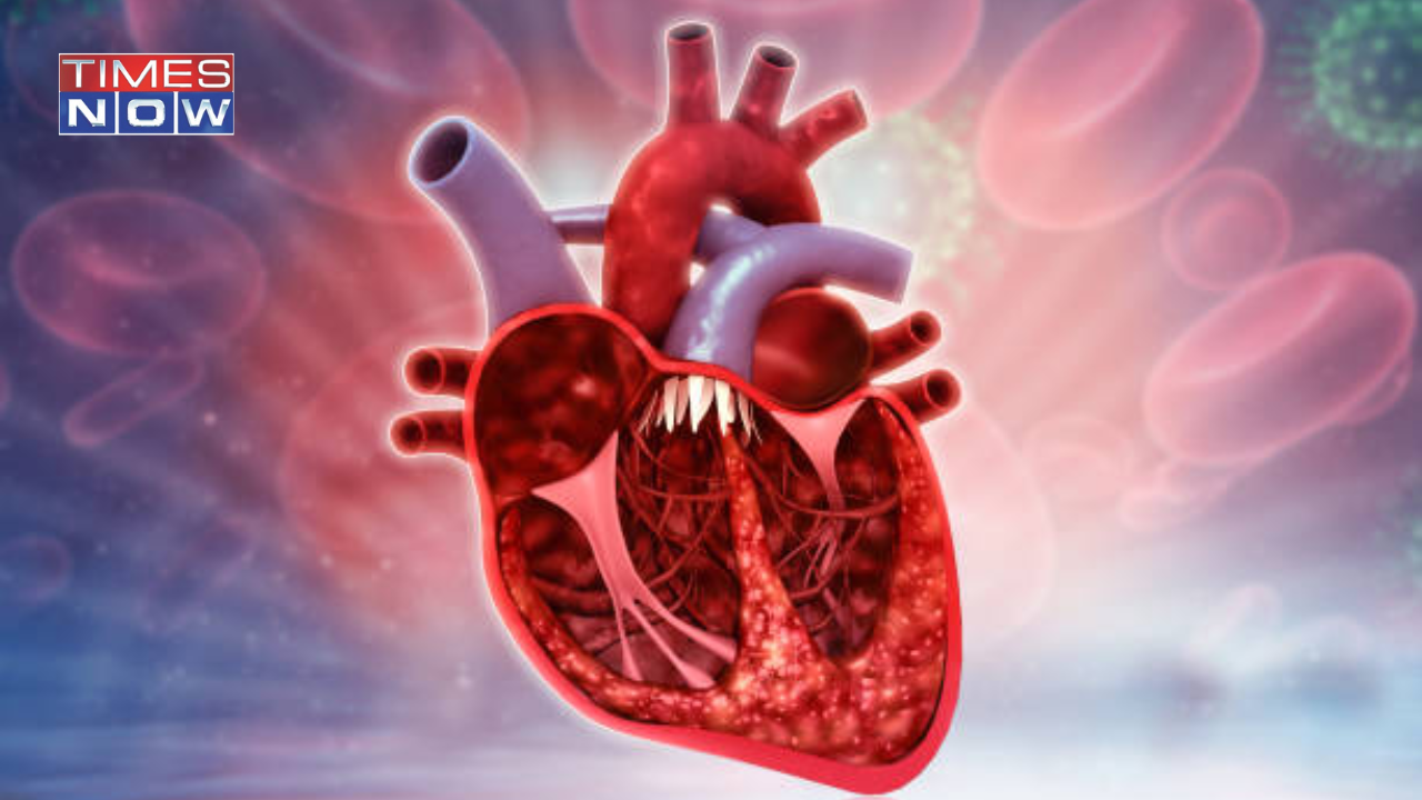 Stanford University Aims To Bioprint Human Heart For Implantation In ...