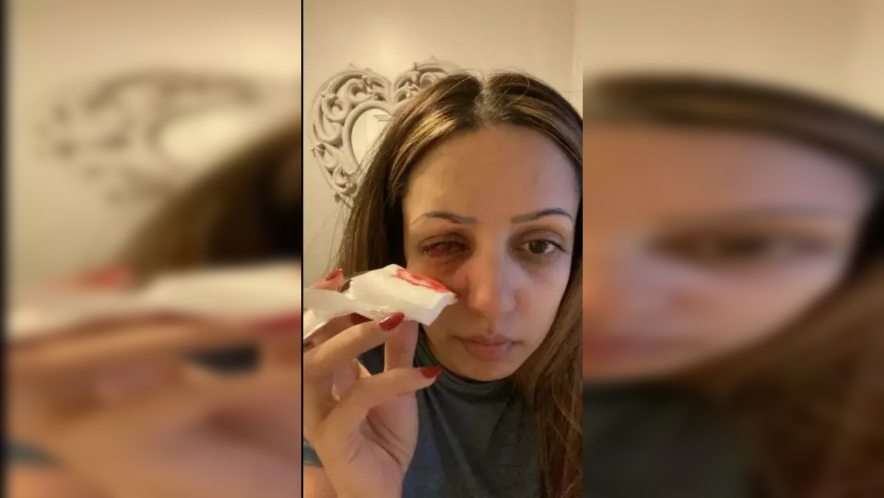 Flesh Eating Parasite Ravages A Woman's Face, Leaving Her Blind In One ...