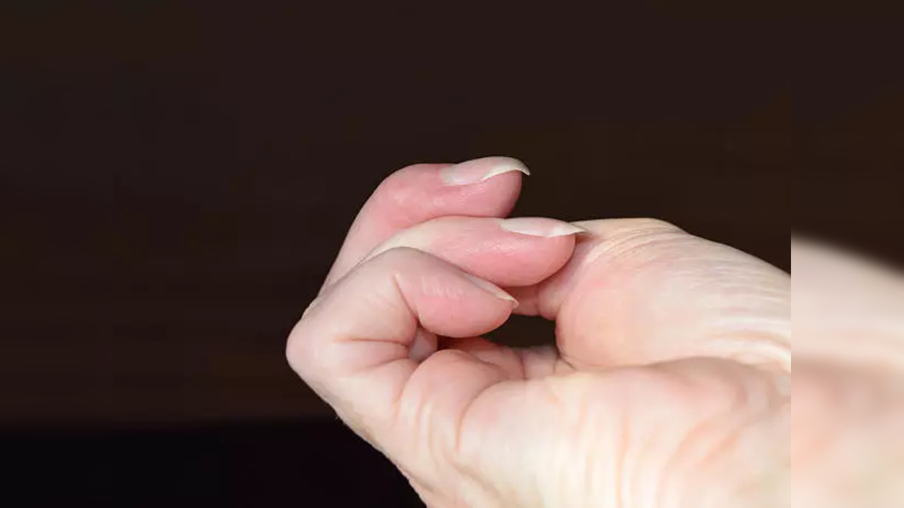 Finger Clubbing: Unusual Deadly Sign Of Lung Cancer | Health News ...