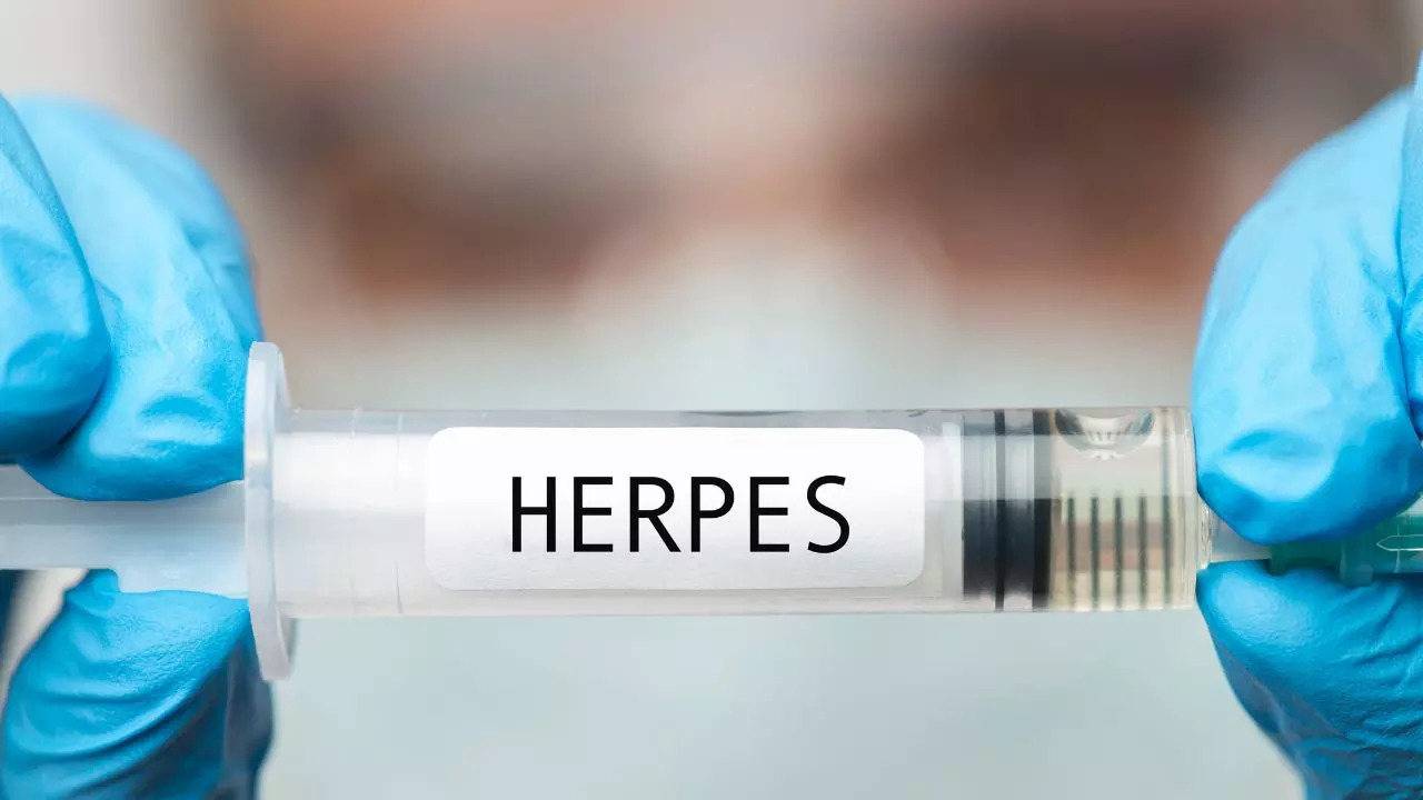 Herpes: Signs, Symptoms And Everything You Should Know About This ...