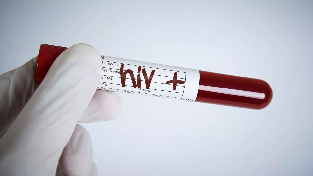 HIV Signs and Symptoms: Causes, Risk Factors and Preventive Measures ...
