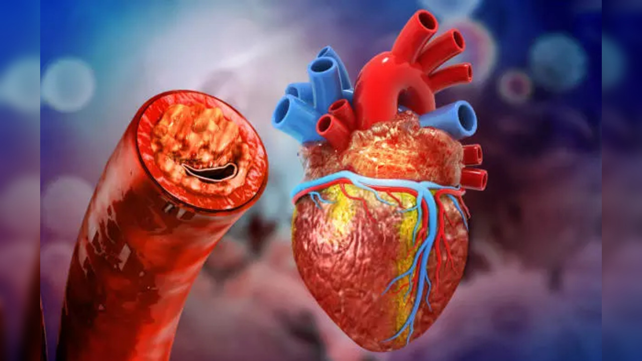 Heart Blockage: Ayurvedic Therapy Claims To Have Completely Cured Heart ...