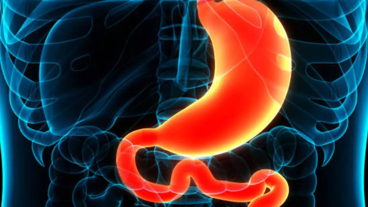 Stomach Cancer: Signs On Your Face That Indicate Early Stages Of A ...