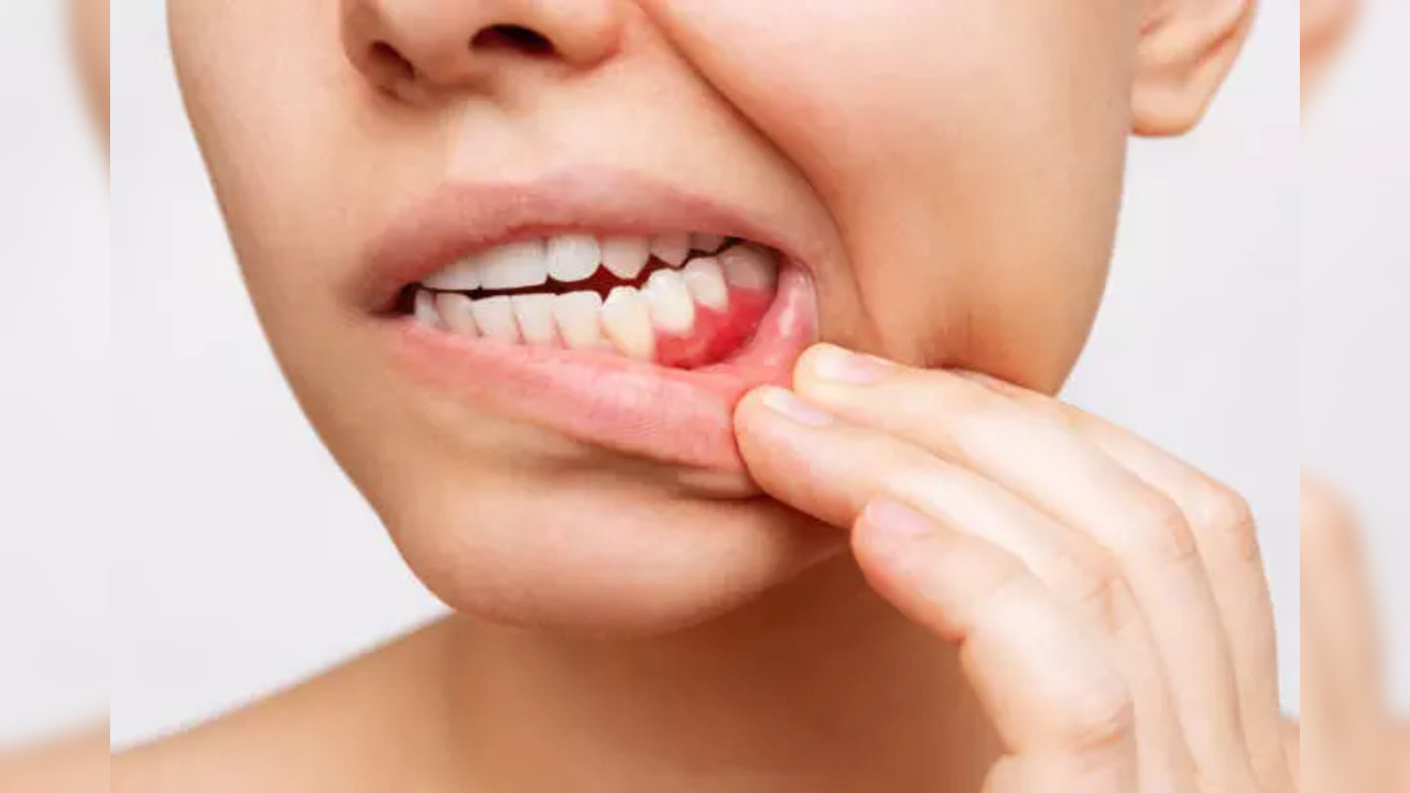 Mental Health and Oral Health: How Does Your Mental Health Affect Teeth ...