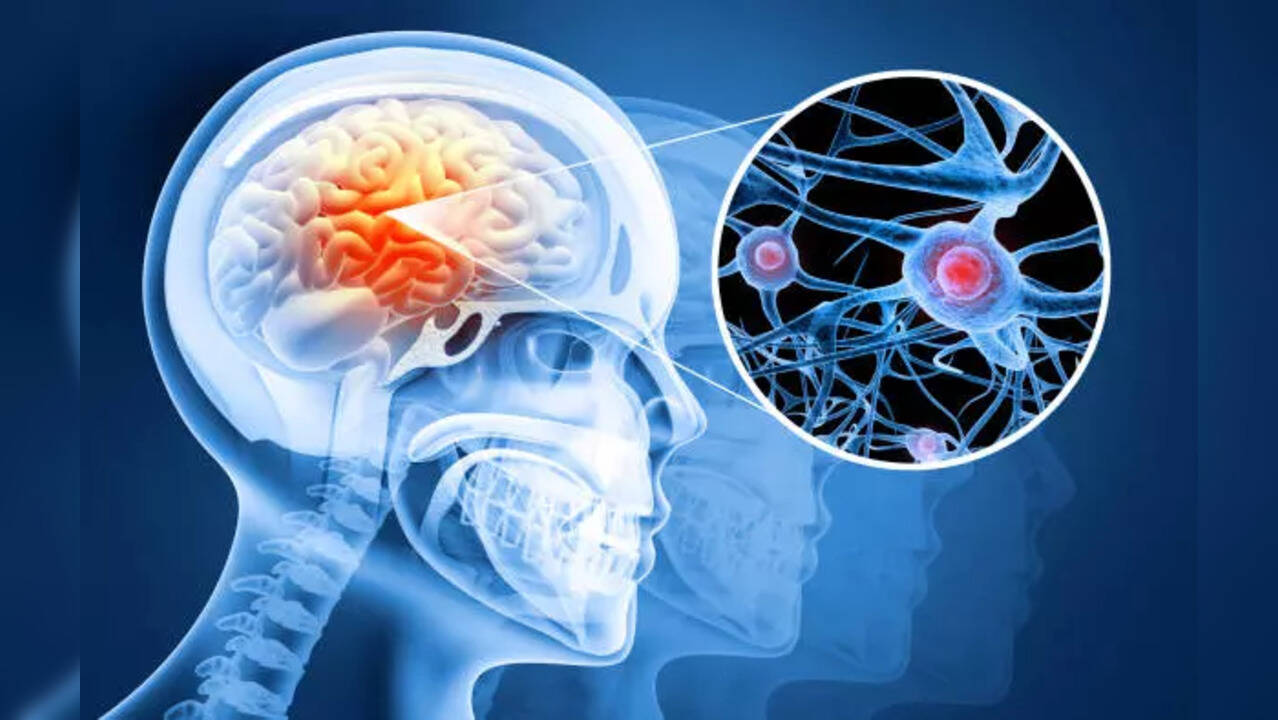 Rugby Player Posthumously Diagnosed With Brain Disease Caused By ...