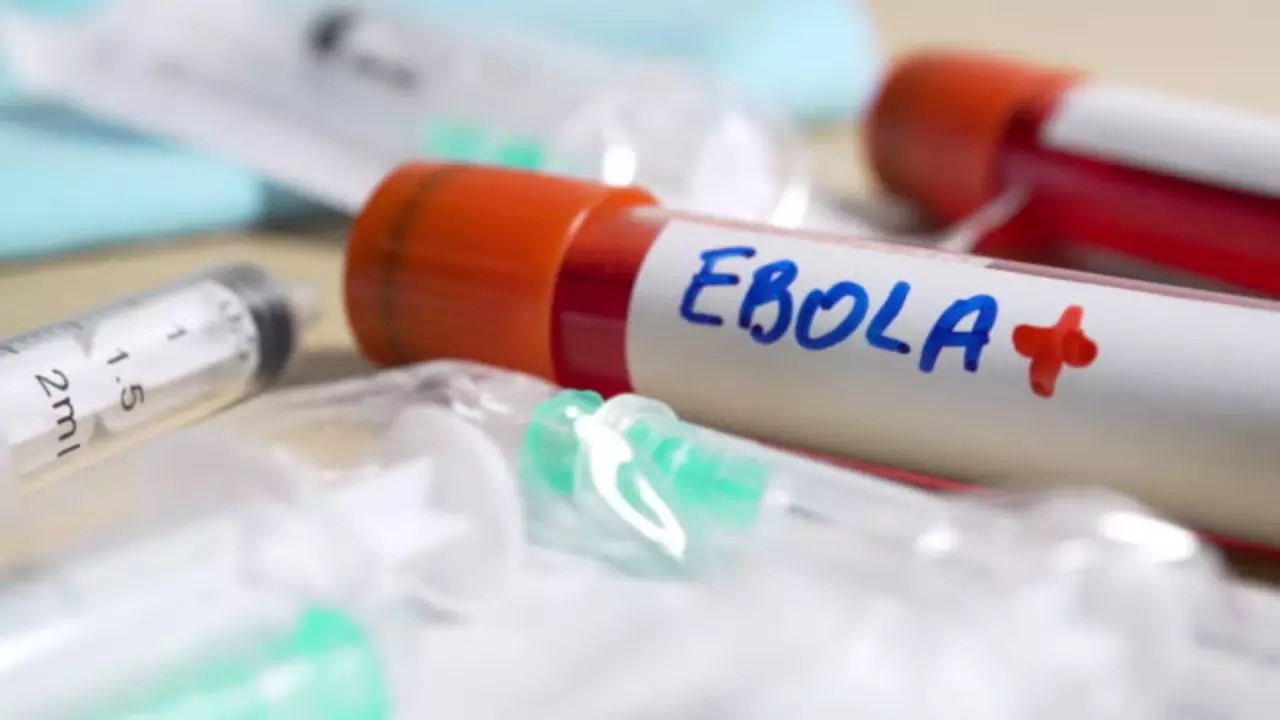 Ebola Virus Prevention: Scientists Found New Drug Target For Ebola ...