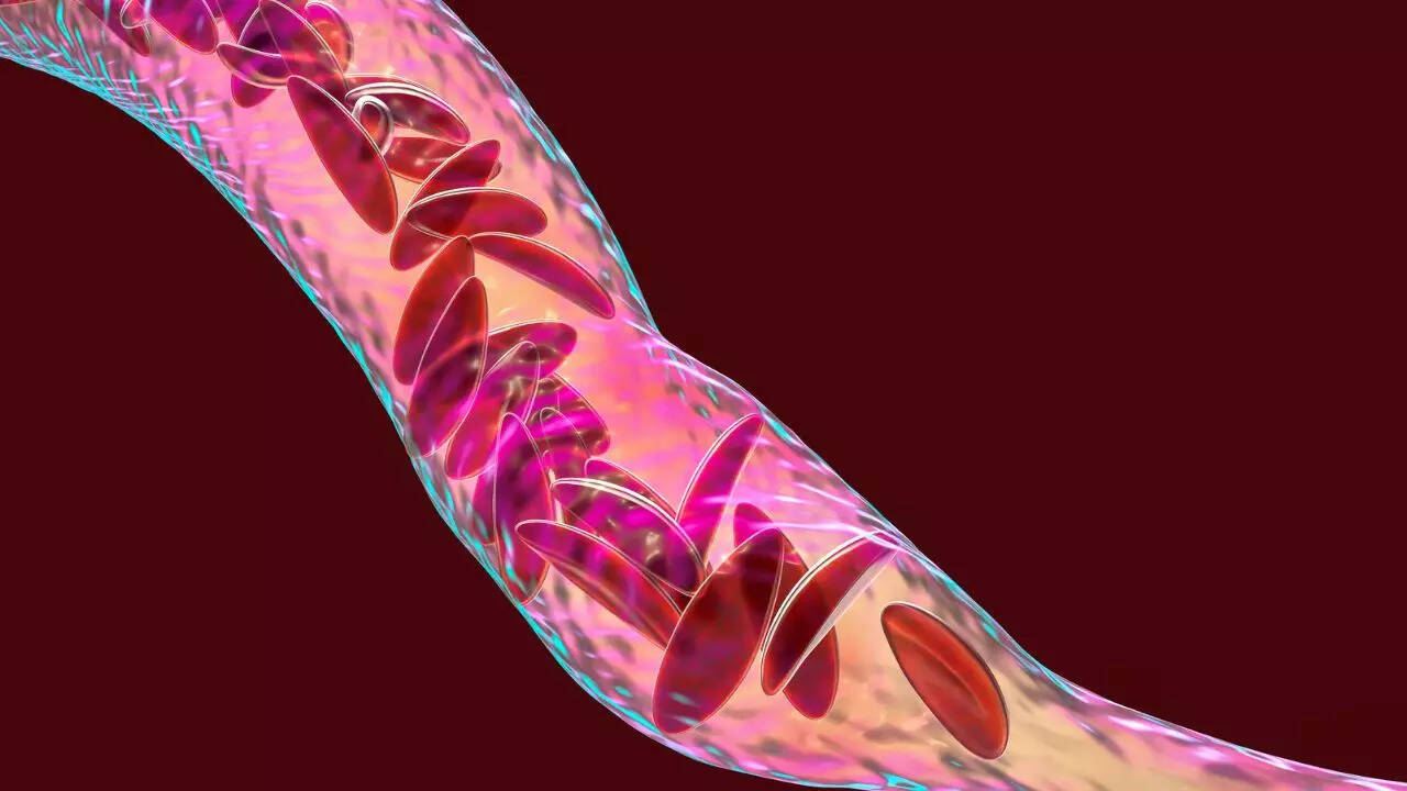 Yoga For Heart Blockage: 8 Yoga Poses That Help To Manage The Condition