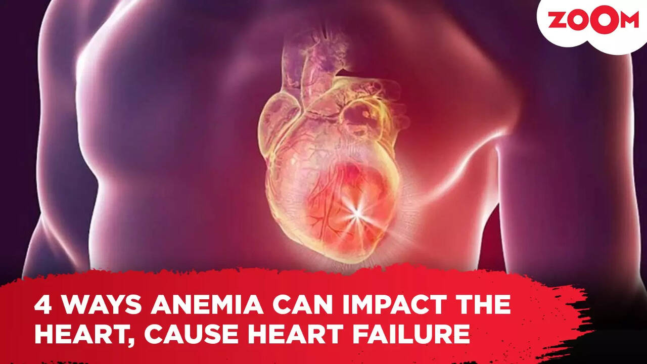 4 ways anemia can impact the heart, cause heart failure | Times Now