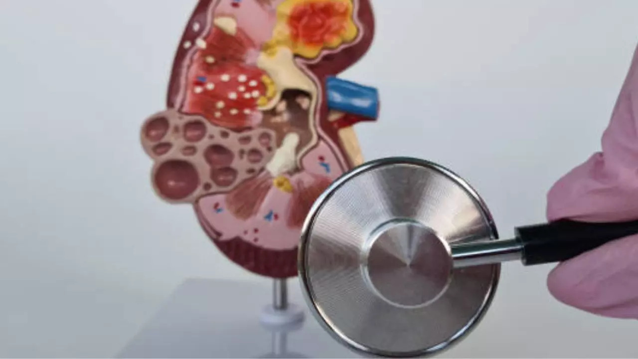 Pig Kidney Recipient Dies: First Person To Receive Genetically Modified ...