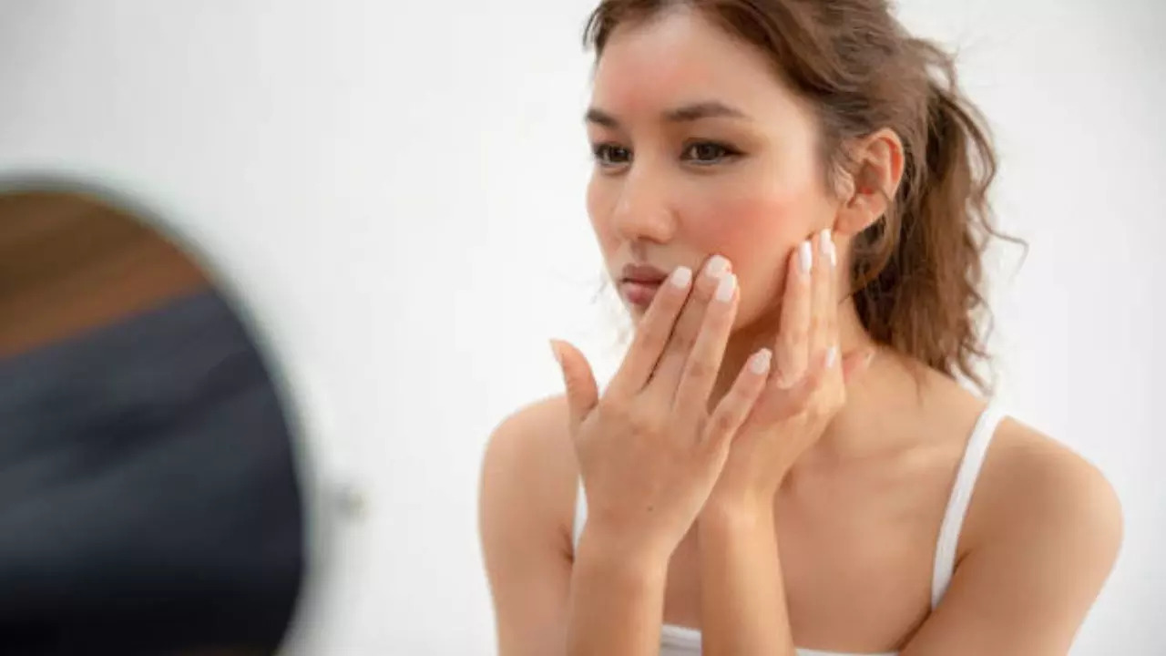 Sexually Transmitted Infection On Face: Symptoms of STDs That Appear On Your Face; Ways To Treat ...