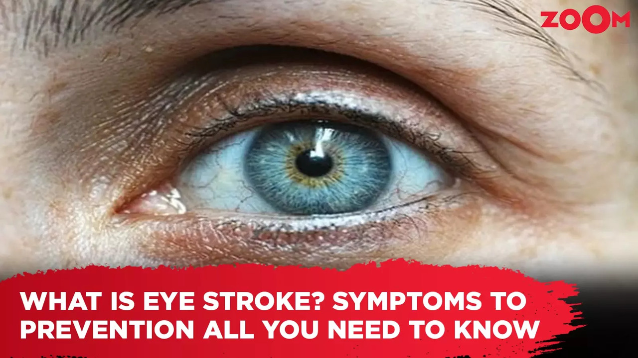 What is an eye stroke? Symptoms to prevention, all you need to know ...