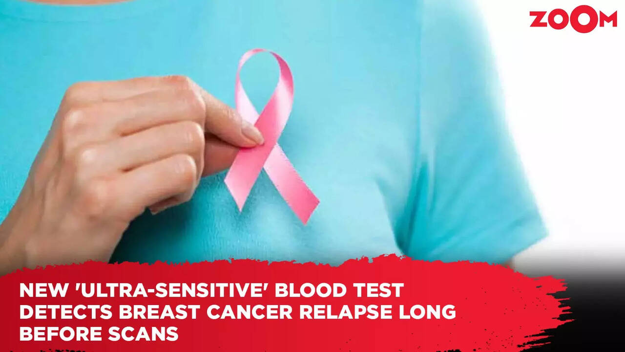 New 'ultra-sensitive' blood test detects breast cancer relapse long ...