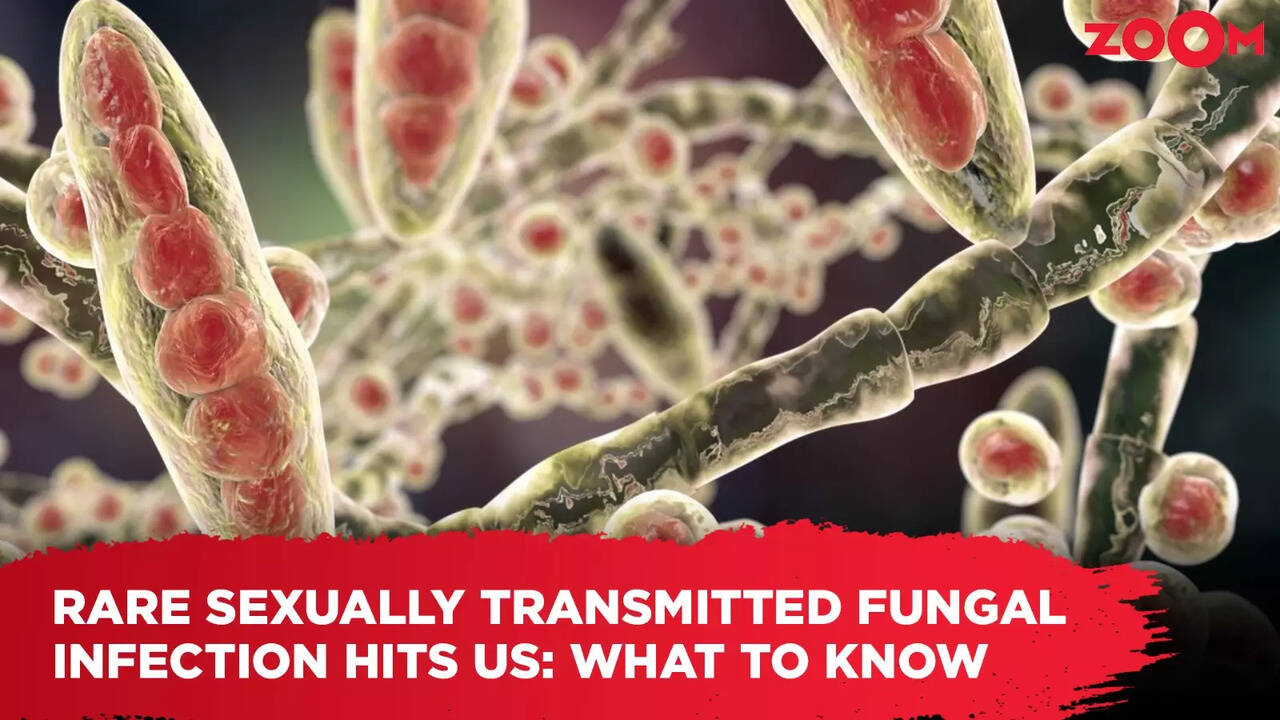 Rare Sexually Transmitted Fungal Infection Hits Us What To Know Times Now