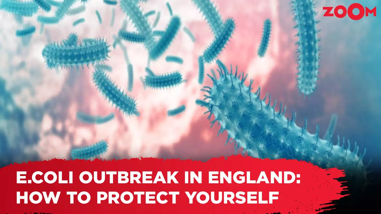 E.coli outbreak in England: How to protect yourself | Times Now