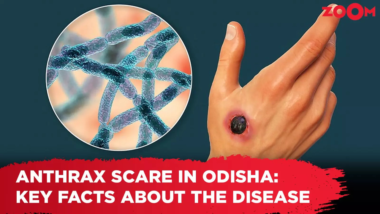 Anthrax outbreak in Odisha: Key facts about the disease | Times Now