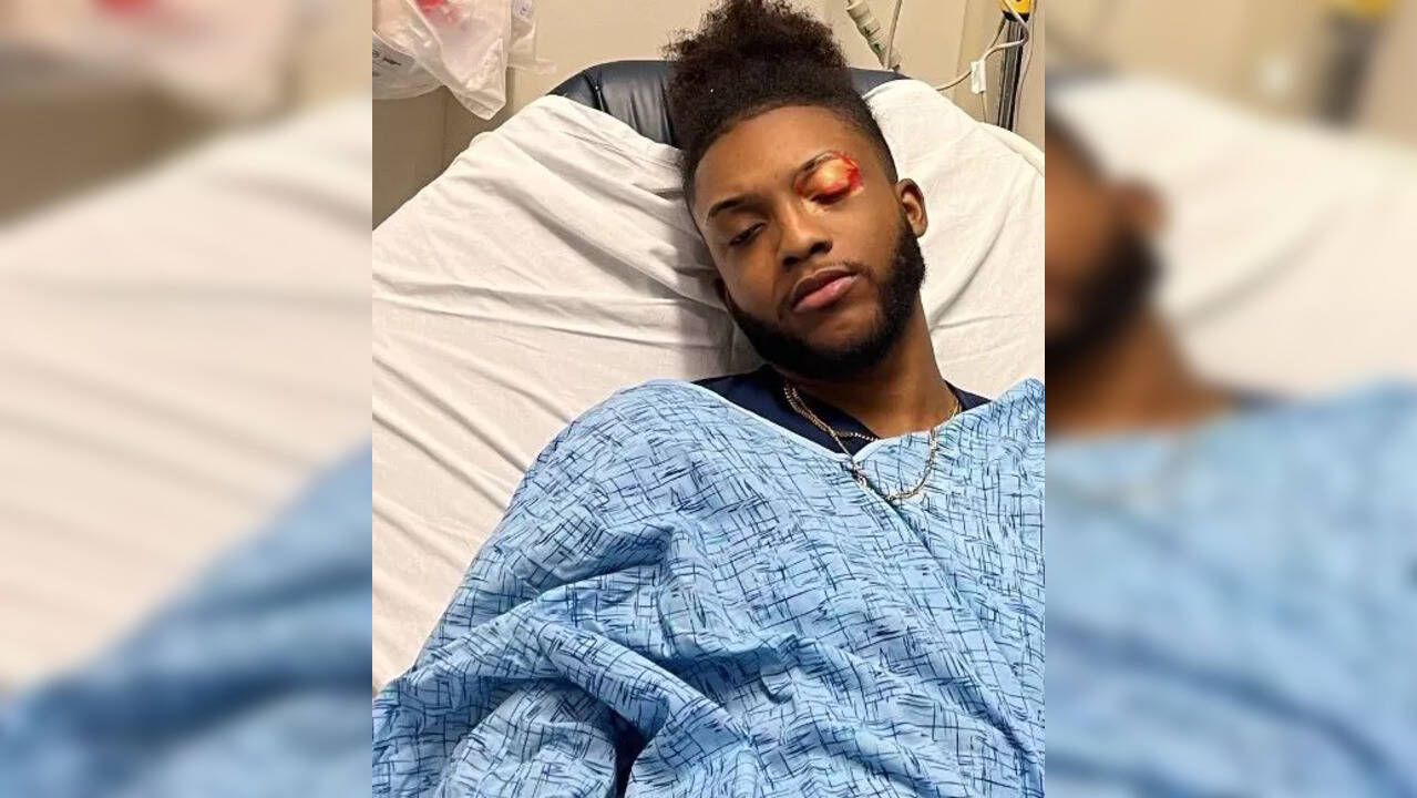 YourRAGE Gives Updated On Eye Injury: 'My Retina And Optical Nerve ...