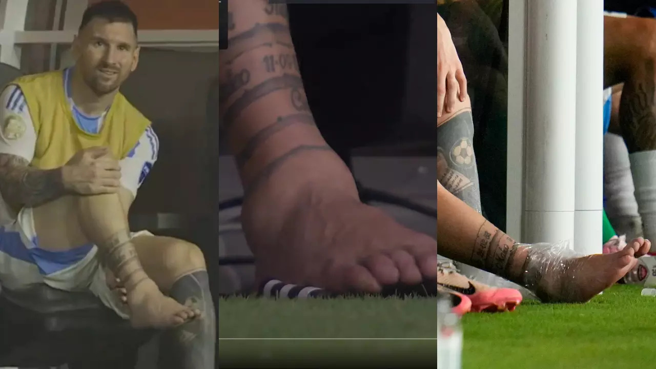 WATCH: Lionel Messi Suffers Freak Injury, Video of Swollen Ankle Goes ...