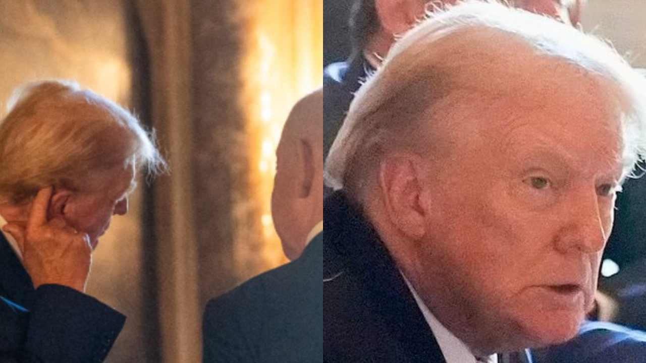 Trump’s ‘No Injury’ Ear At Netanyahu Meeting Revives Claims That He ...