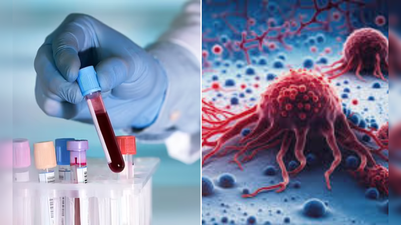 Blood Cancer ची ही आहेत 5 लक्षणे, अजिबात करू नका दुर्लक्ष | Times Now ...