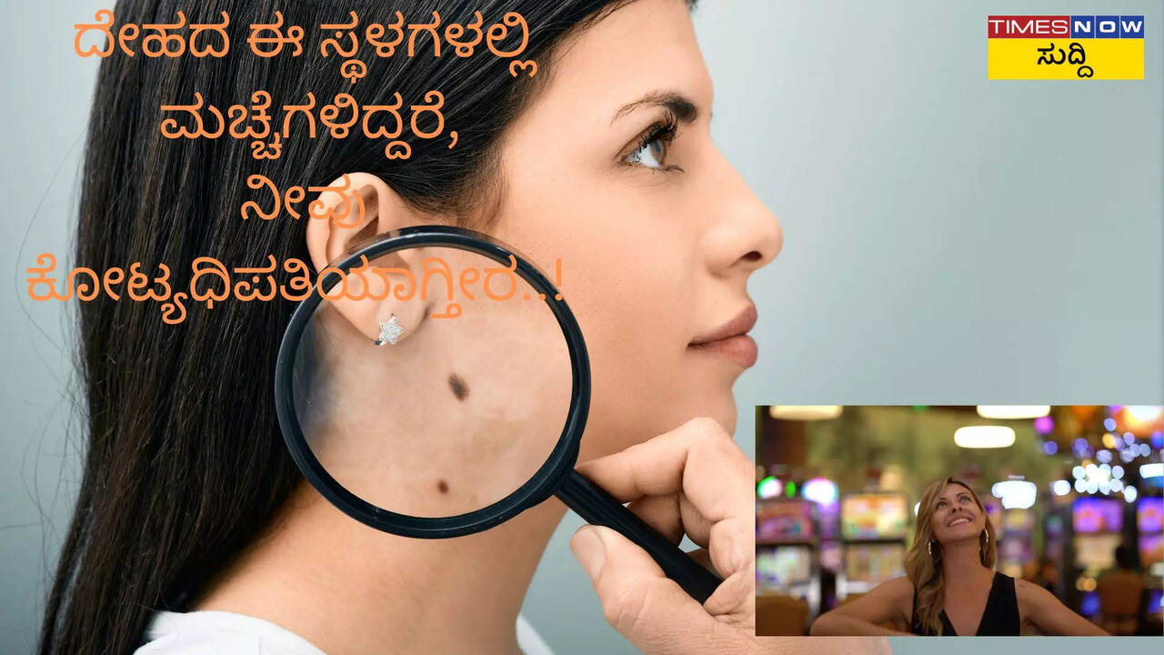 Samudrik Shastra: ದೇಹದ ಈ ಸ್ಥಳಗಳಲ್ಲಿ ಮಚ್ಚೆಗಳಿದ್ದರೆ, ನೀವು ...