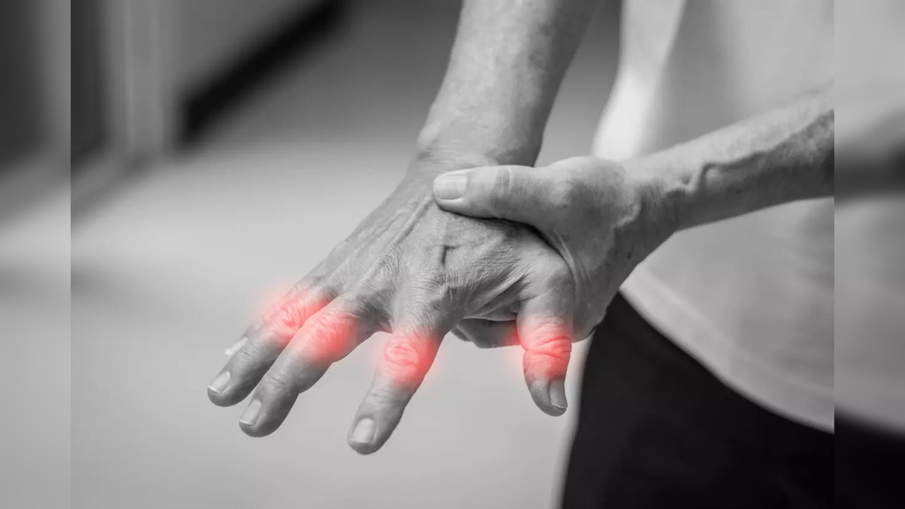 Stiff Skin Syndrome: This rare disease can make the skin turn stony ...