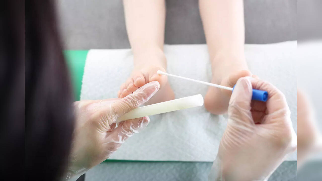 Is hair fall a side effect of smear tests? Watch out for these