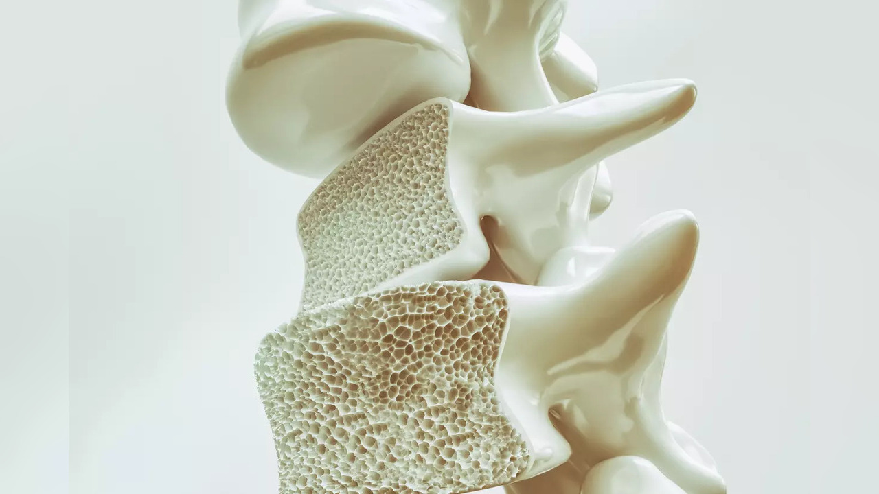 Osteoporosis: Are you suffering from bone loss? These signs can ...