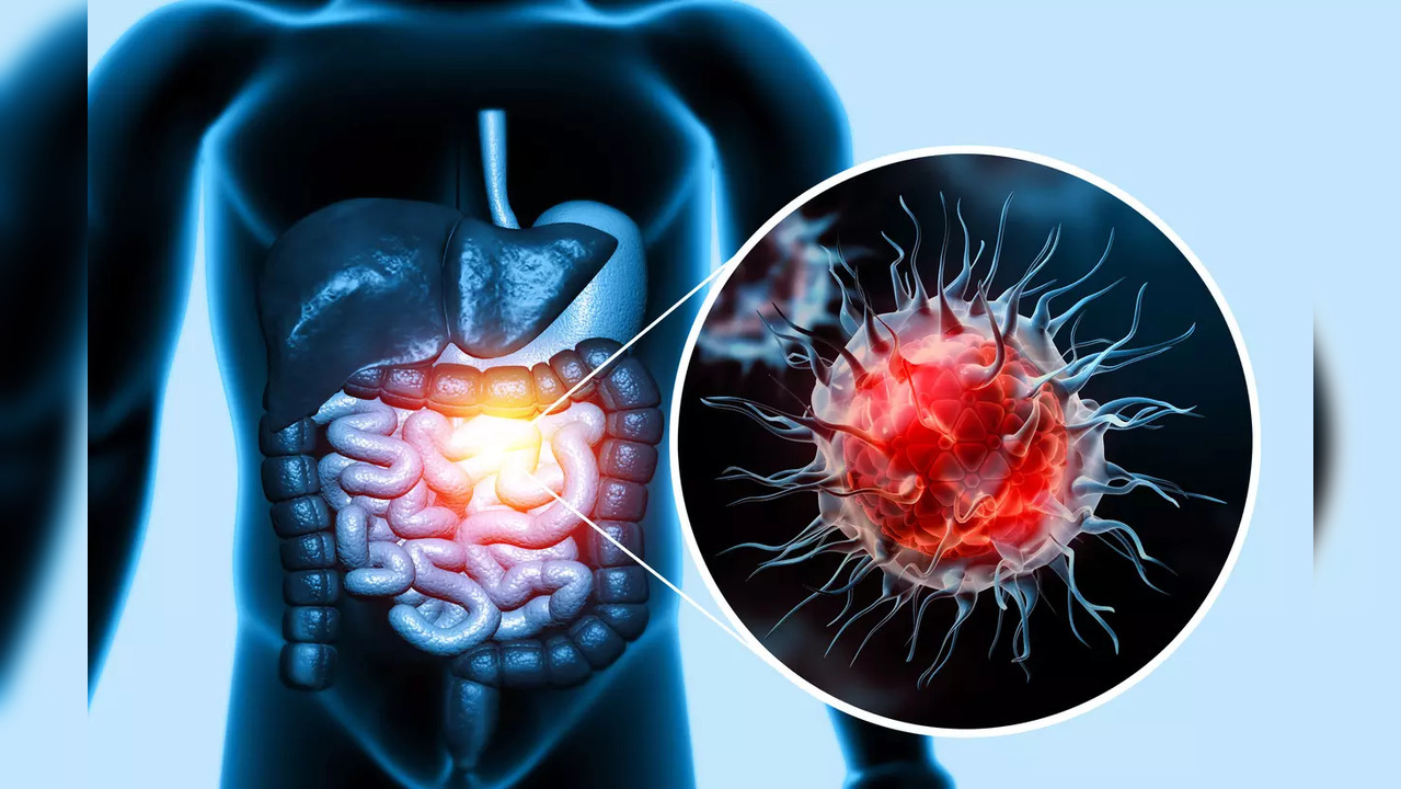 Colorectal cancer awareness month: Doctors name symptoms you must not ...