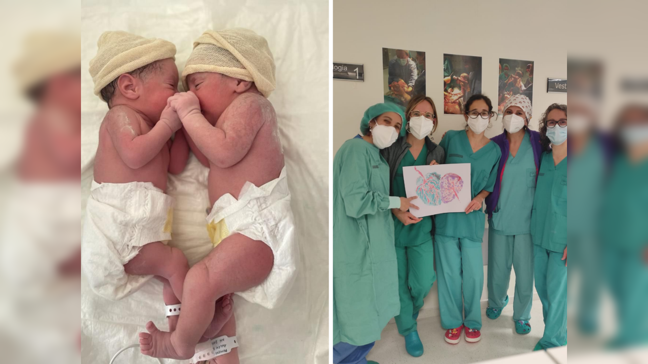 Rare birth | Twin born still inside amniotic sac in very rare, one-in ...
