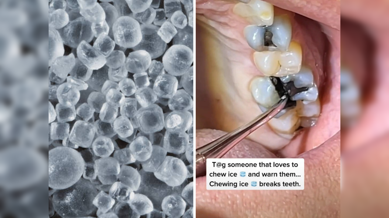 Dentist shares graphic clip and tells why we should not chew ice ...