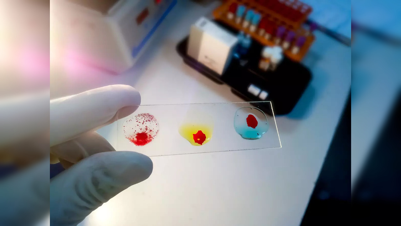 Watch out, study says people with THIS blood type are at high risk of ...