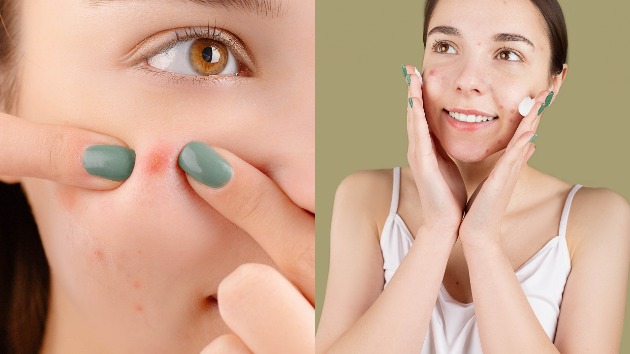 Diy: Waking up every morning with random spots on your face? Here are a ...